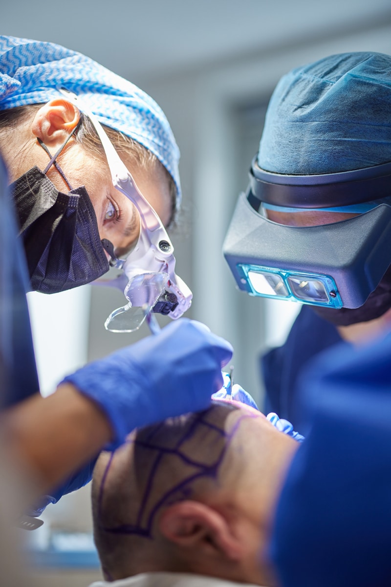 Traitements Mésothérapie | Chute de Cheveux, Calvitie, Alopécie